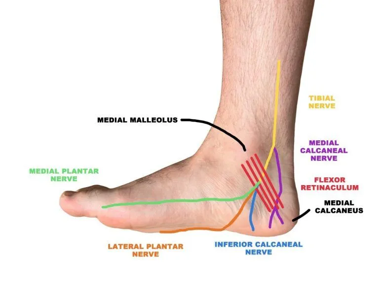 sural nerve issues