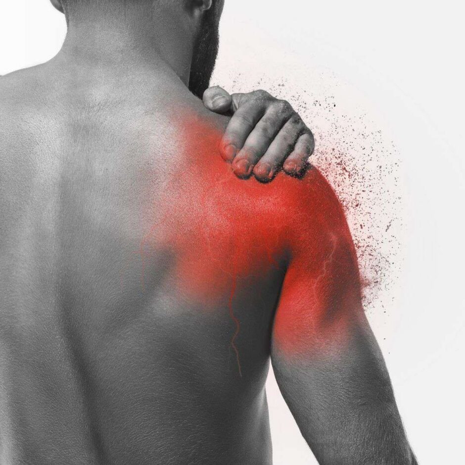 Frozen Shoulder - Adhesive Capsulitis – Peak Sport And Spine Centre